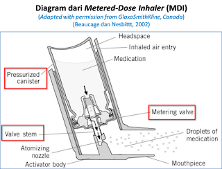 KAMPOENG ASMA: CARA PENGGUNAAN MDI (METERED-DOSE INHALER)