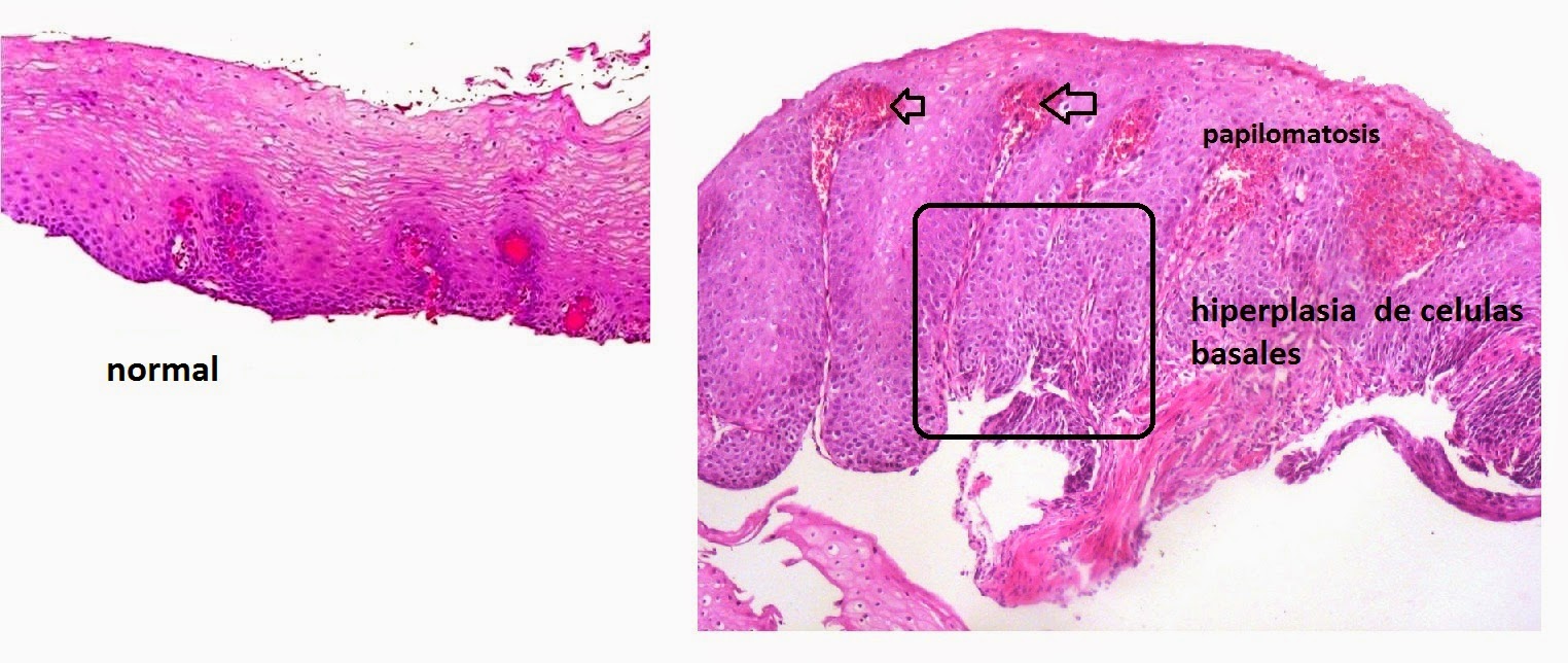 GASTROINTESTINAL AND LIVER HISTOLOGY PATHOLOGY ATLAS: ESOPHAGUS ...