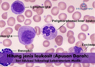 Hitung jenis leukosit (Apusan Darah)