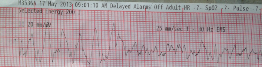 EM Didactic: Resuscitation: When do we call it off?