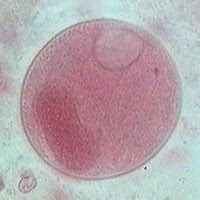 จุลชีววิทยาเเละปรสิตทางสาธารณสุข: Protozoa