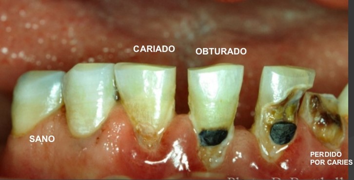SONRÍE SIN MIEDO Y FELIZ: PARA QUÉ UTILIZAMOS EL ÍNDICE DE CPO?