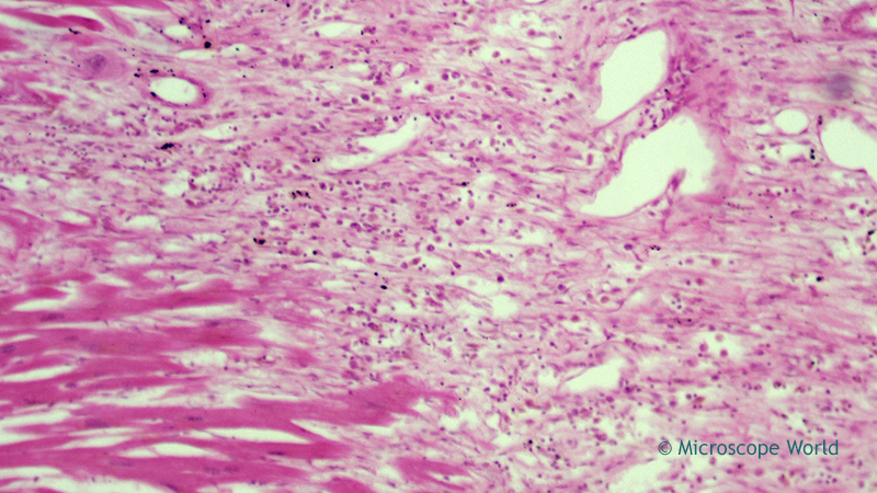 Microscope World Blog: Heart Attack Awareness & Prevention