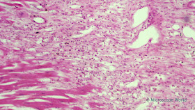 Microscope World Blog: Heart Attack Awareness & Prevention