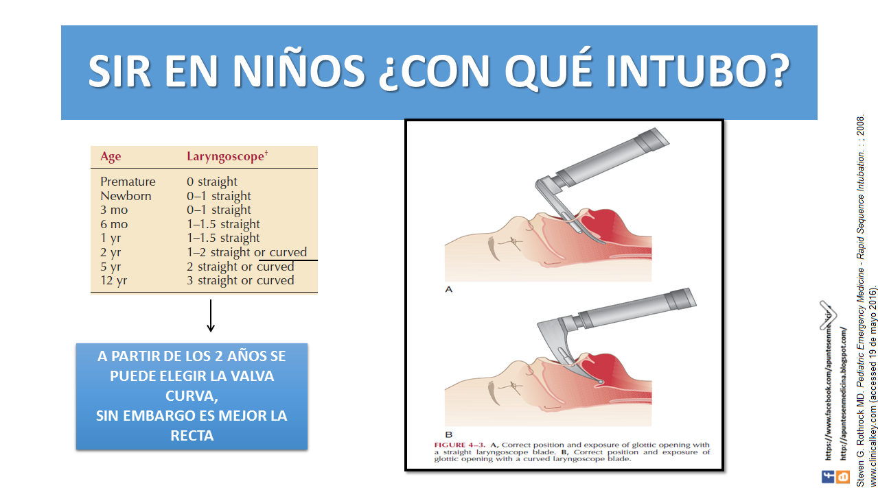 Apuntes en medicina: Secuencia de intubación rápida en pediatría ¿Sabes ...