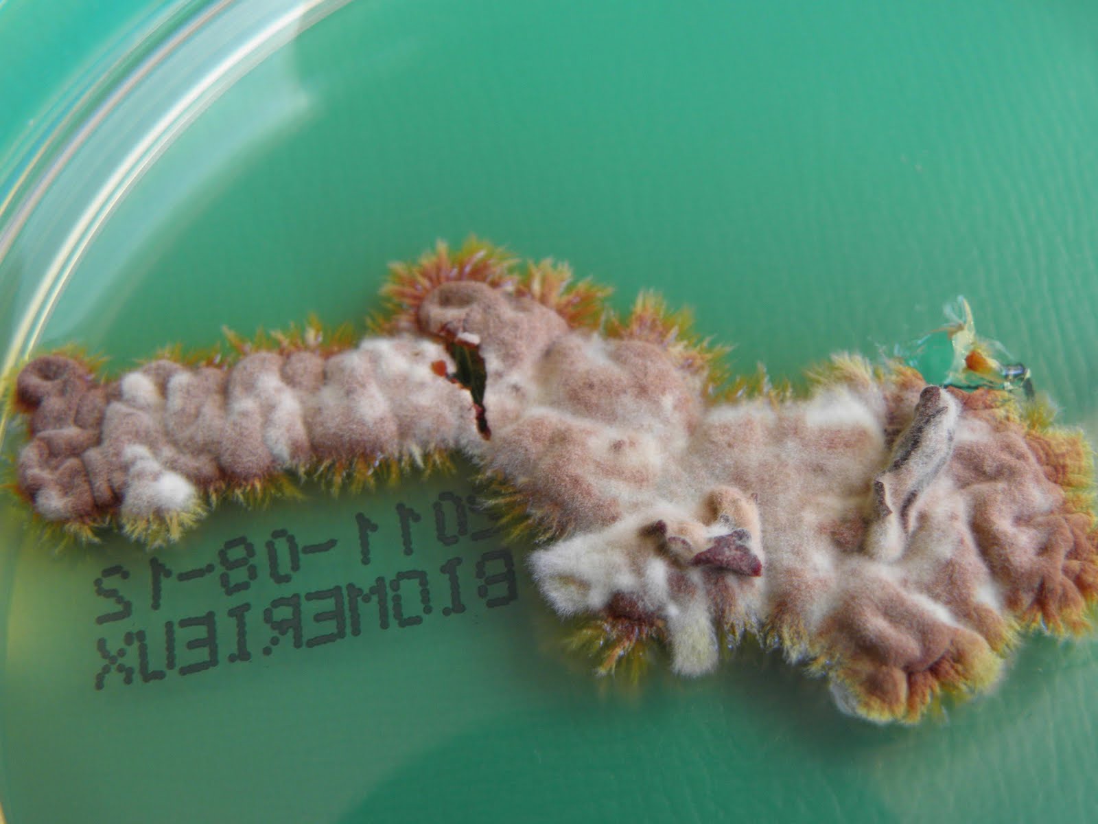 ATLAS MICOLOGIA: TRICHOPHYTON SOUDANENSE