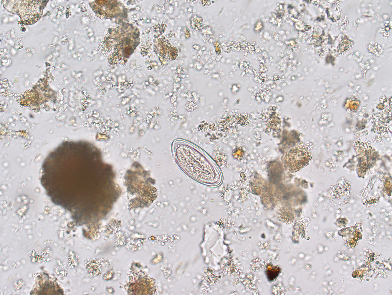 Enterobius Vermicularis Labeled