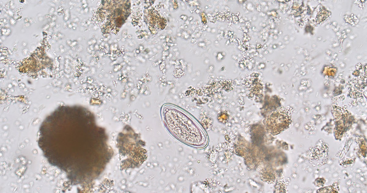 Creepy Dreadful Wonderful Parasites: Case of the Week 434