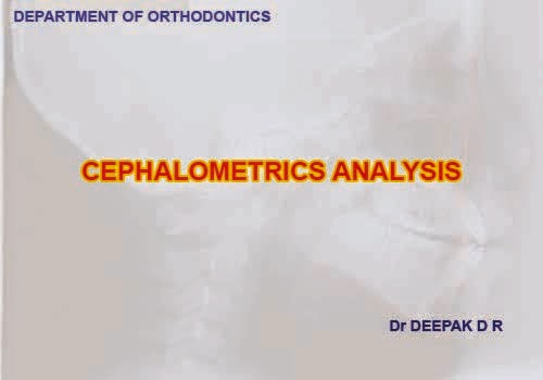 DENTAL MIRACLE .........: Cephalometric Analysis