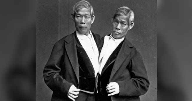 renatodiniz.com: A FASCINANTE HISTÓRIA DOS IRMÃOS SIAMESES QUE TIVERAM ...