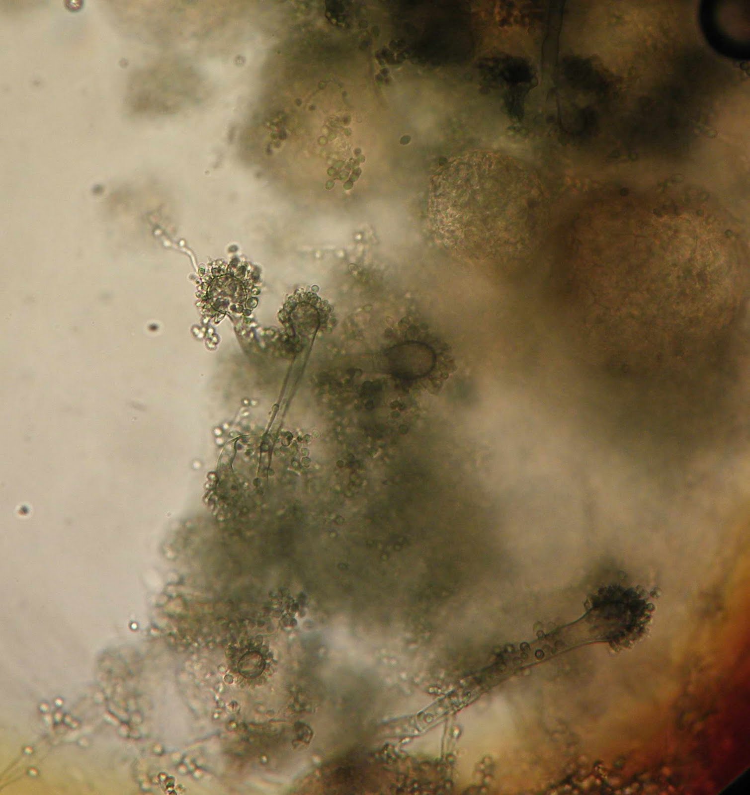 ATLAS MICOLOGIA: ASPERGILLUS GLAUCUS