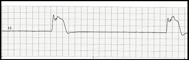 Basic EKG Rhythm Test 07