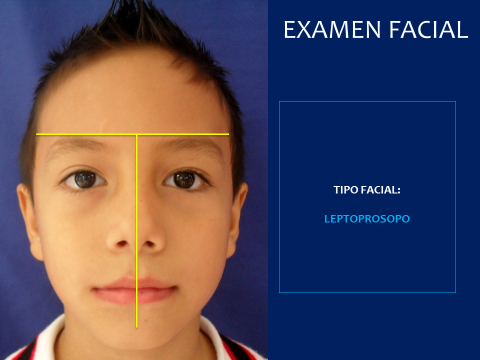 ANALISIS DE SONRISA: ANALISIS DE SONRISA, INTRODUCCION A LA ODONTOLOGIA