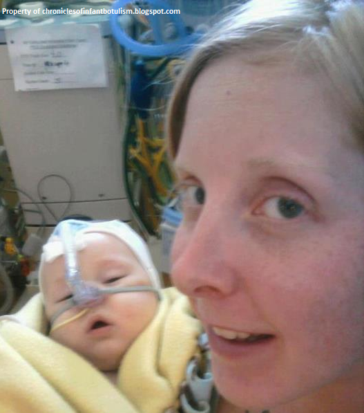 Chronicles of Infant Botulism: Baby T's Story, Chapter 8- Extubated