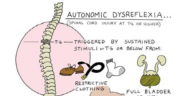 SUPAHNARS: AUTONOMIC DYSREFLEXIA