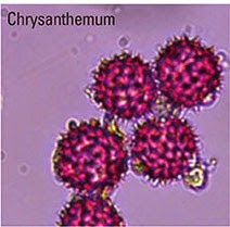biology blog!!!!: Pollen under the Compound Microscope
