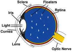 Eyecare Insights: What is that floating spot in my vision?