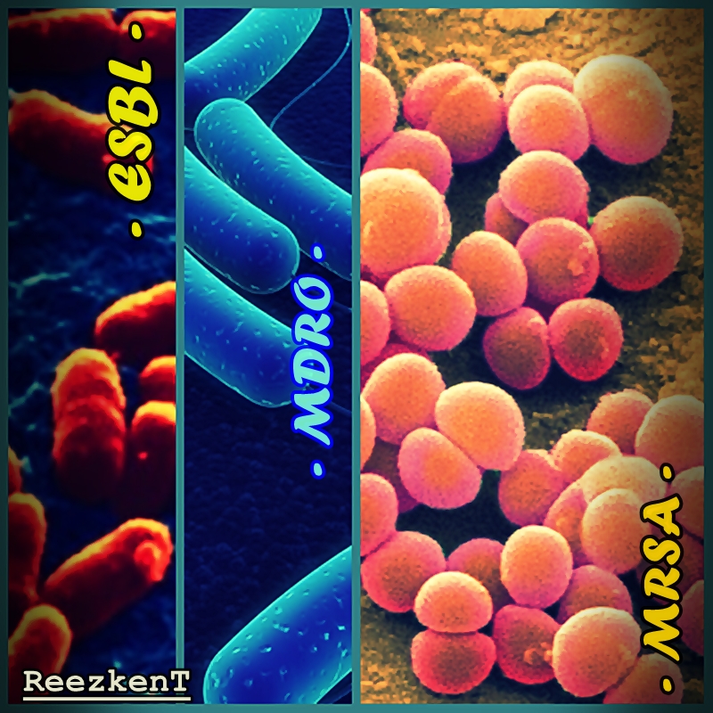 mine's: ESBLs, MDRO, MRSA / 15 - 04 - 2013