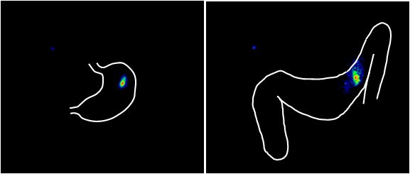 Drug Delivery Blog: IntelliCap – accelerating drug development with the ...