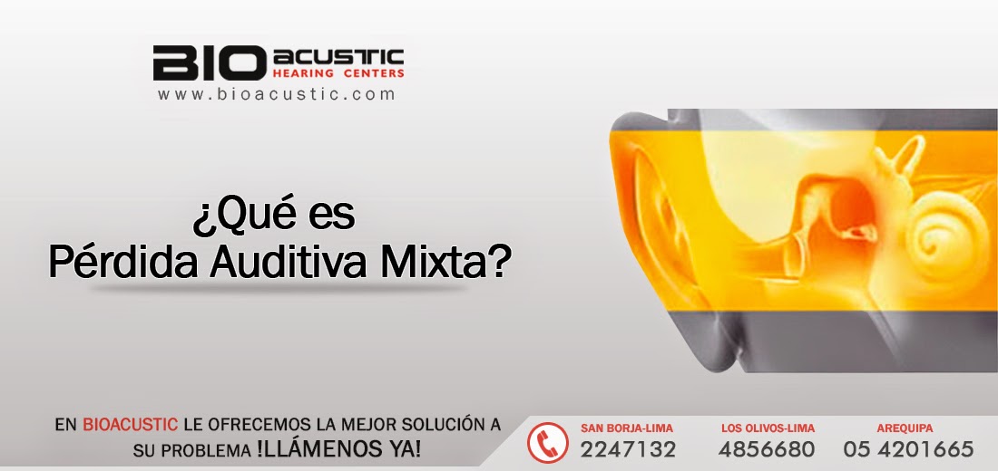 Audifonos para Sordera: Tipos de Pèrdida Auditiva: PÉRDIDA AUDITIVA MIXTA