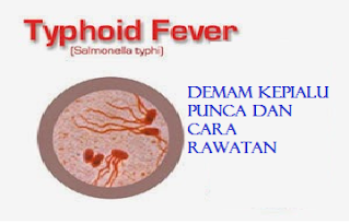 Demam Kepialu Punca Dan Cara Rawatan - JunaBlogg