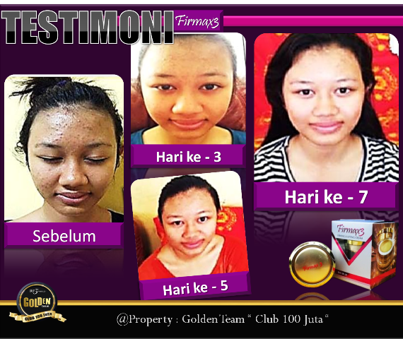TESTIMONI PENGGUNA CREAM AJAIB FIRMAX 3 | FIRMAX 3 CREAM AJAIB