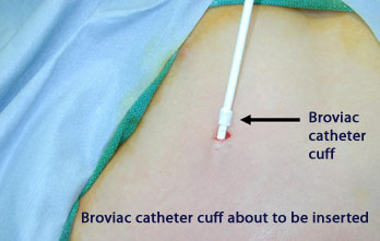 Our Beautiful Family: TPN???