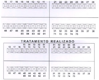 Odontograma - Sua importância - Coisa de Dentista