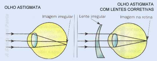 NOBREGANEWS: Os Defeitos da Visão. Doenças que afetam o olho humano ...