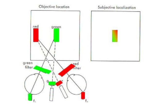 Test de Hess Lancaster
