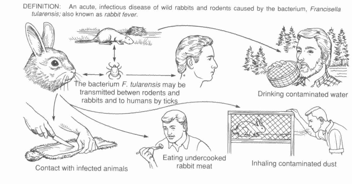 Ghalapulla: Penyakit Tularemia ( Francisella tularensis)