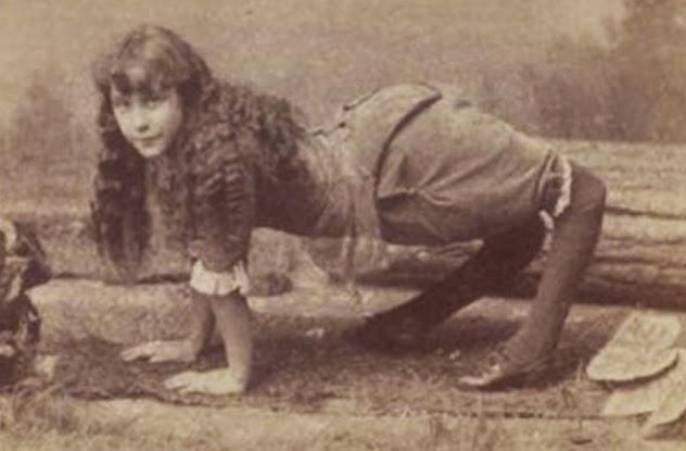 People with Unique Physical Deformities - Art'einsky