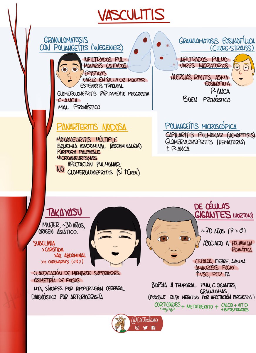 ZONA DE SALUD DE OFRA: Breve repaso de las Vasculitis.