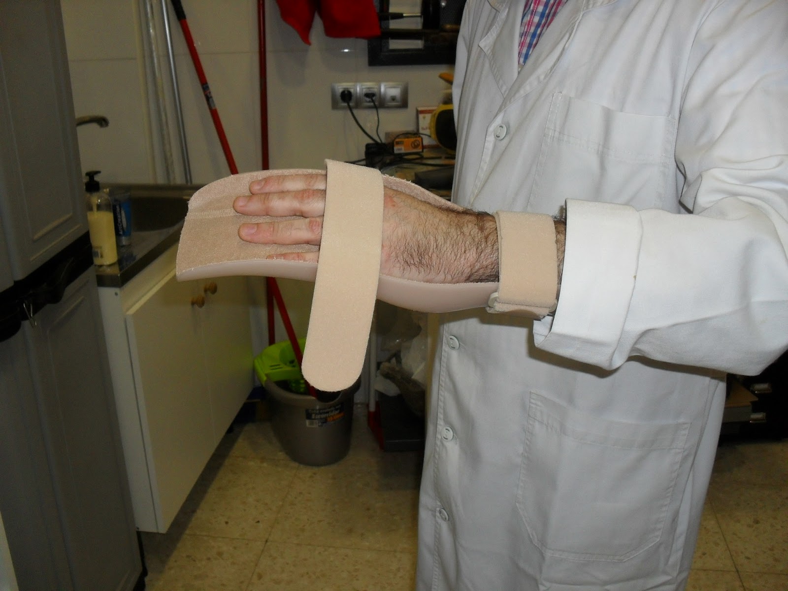 FERULA INMOVILIZADORA DE MANO EN POSICION FUNCIONAL Y OPOSICION DEL PULGAR
