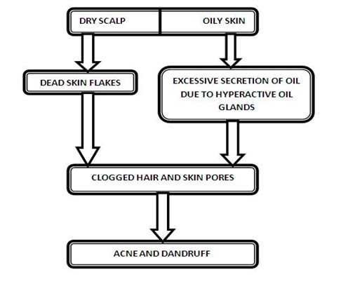 Redefining the Face Of Beauty : WHAT IS DANDRUFF & WHAT PRODUCTS TO USE?