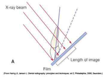 Dentistry and Medicine: Intraoral Radiographic Techniques (The ...