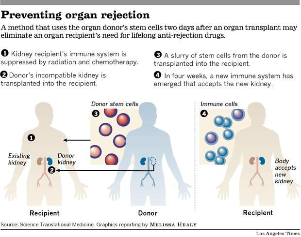 Pancreas: Pancreas Transplant Rejection