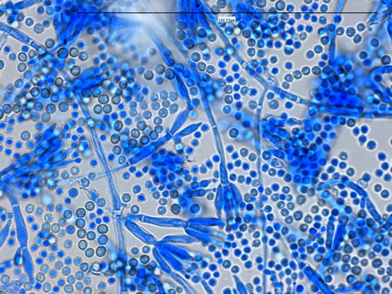 Fun With Microbiology (What's Buggin' You?): Penicillium citrinum