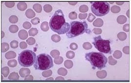 Fichero de Hematología: 2016