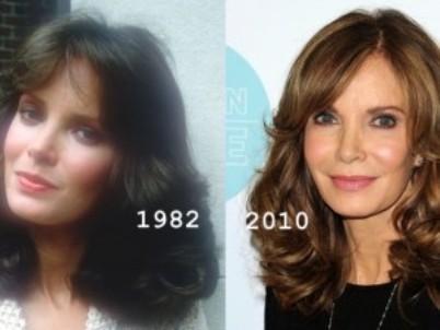 Jaclyn Smith Plastic Surgery