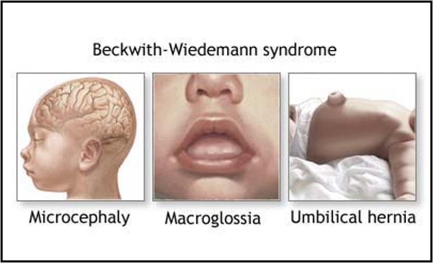 Dentistry lectures for MFDS/MJDF/NBDE/ORE: Developmental Disturbances ...