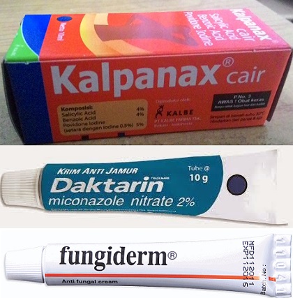 Obat panu di apotik yang ampuh untuk menghilangkan panu | De'Blast