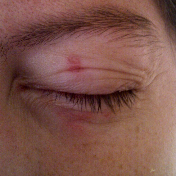 Sandra's Latest: Acid bug attack...