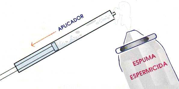 Métodos anticonceptivos