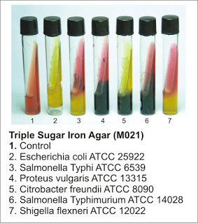 Media Triple Sugar Iron Agar (TSIA) ~ Medical Laboratory Technologist