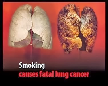 Bahaya Merokok: Efek Negatif Nikotin Pada Paru-Paru | Blog Cara dan Tips