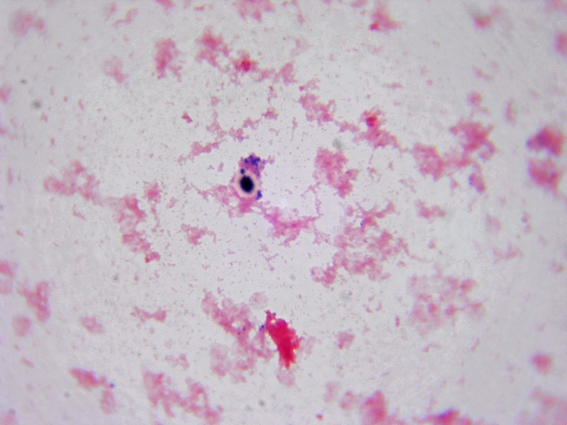 Fun With Microbiology (What's Buggin' You?): Alternative Stains ...