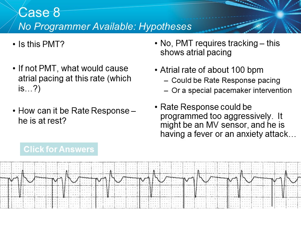 CVT Mohd Farid: Basic Pacemaker Troubleshooting Part II-Medtronic Academy