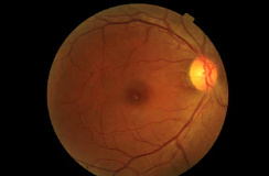 Beatriz Mayoral: Anatomía: El disco óptico