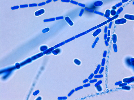 Fun With Microbiology (What's Buggin' You?): Geotrichum candidum